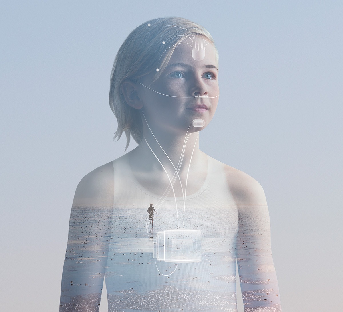 Polysomnography – The gold standard in diagnosing Sleep apnea - CALAPHARCO