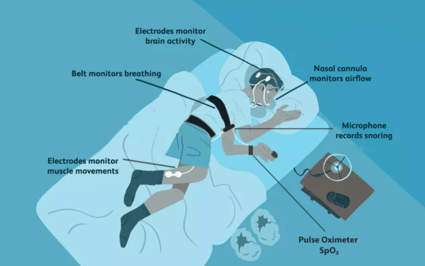 Sleep Test: What will happen and Tips to Prepare - CALAPHARCO